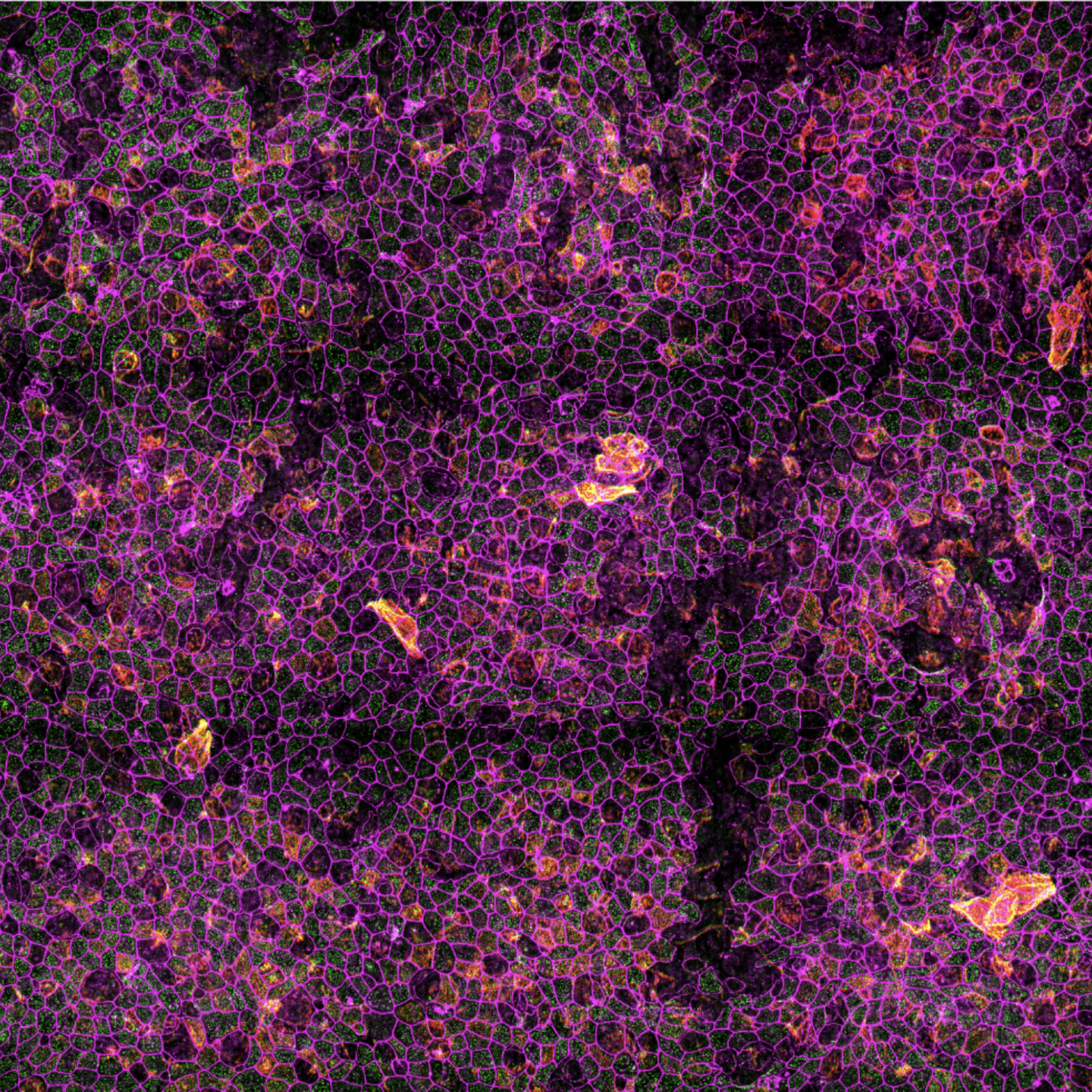 Single Cell Airway Biology at the Nanoscale