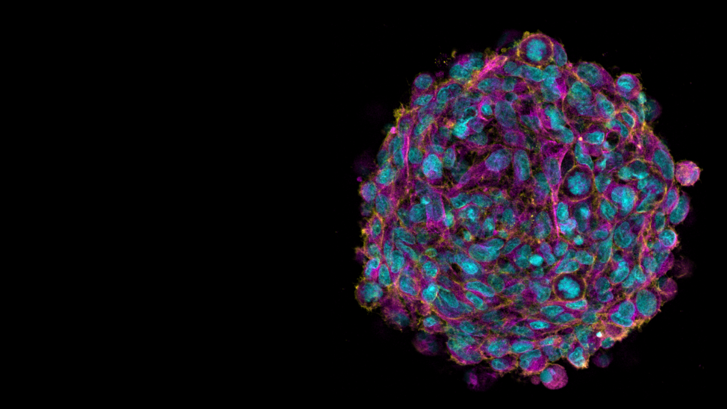 A New Very High-content Imaging Approach for 3d Cell Models